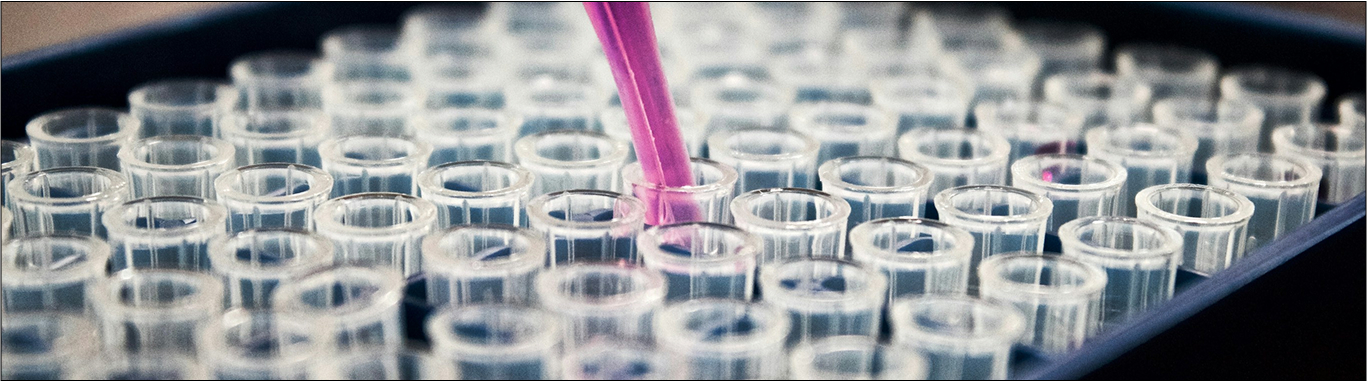 Project Background - NUE-Leg